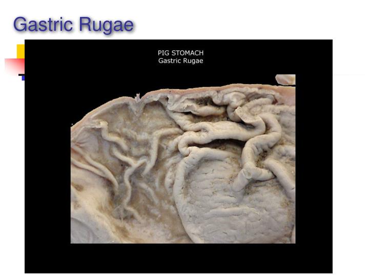 PPT - DIGESTIVE SYSTEM PowerPoint Presentation - ID:4793792