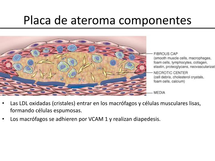 PPT - Fisiopatología de las Enfermedades Coronarias Isquémicas (Angina ...