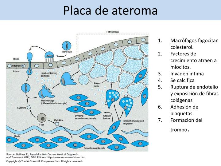PPT - Fisiopatología de las Enfermedades Coronarias Isquémicas (Angina ...