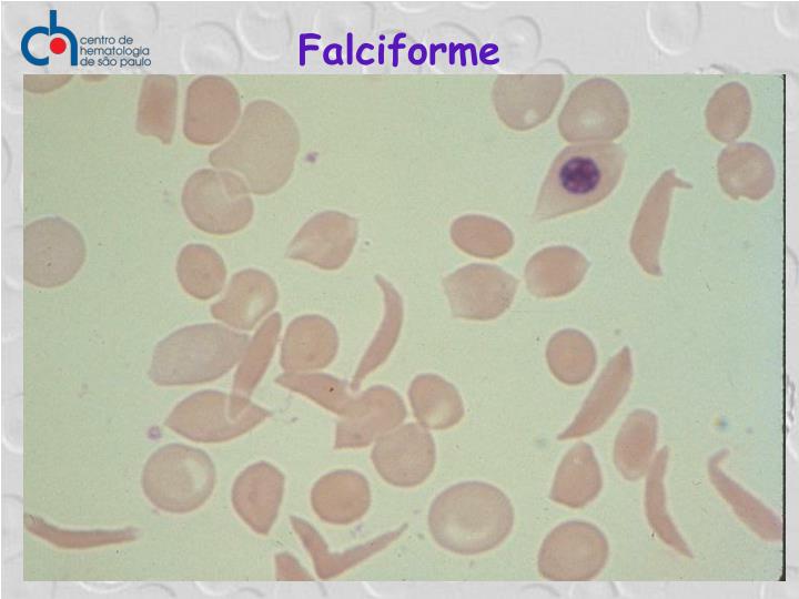 PPT - O HEMOGRAMA PowerPoint Presentation - ID:4794478