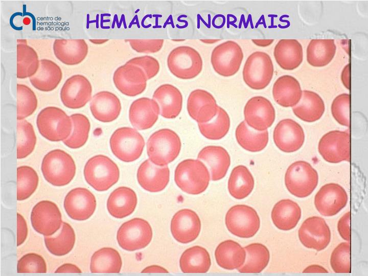 PPT - O HEMOGRAMA PowerPoint Presentation - ID:4794478