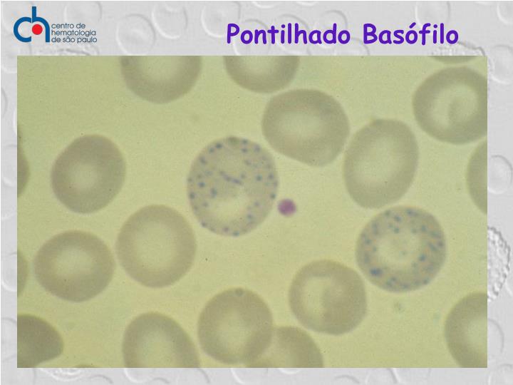PPT - O HEMOGRAMA PowerPoint Presentation - ID:4794478