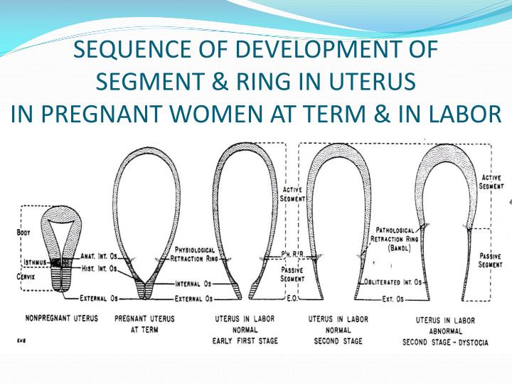 PPT - Lecture 5 PHASES OF PARTURITION STAGES OF LABOR MECHANISM OF ...