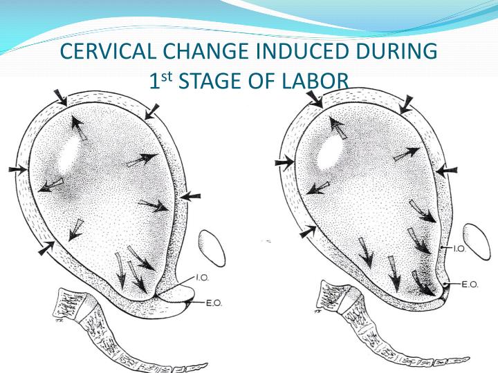 PPT - Lecture 5 PHASES OF PARTURITION STAGES OF LABOR MECHANISM OF ...