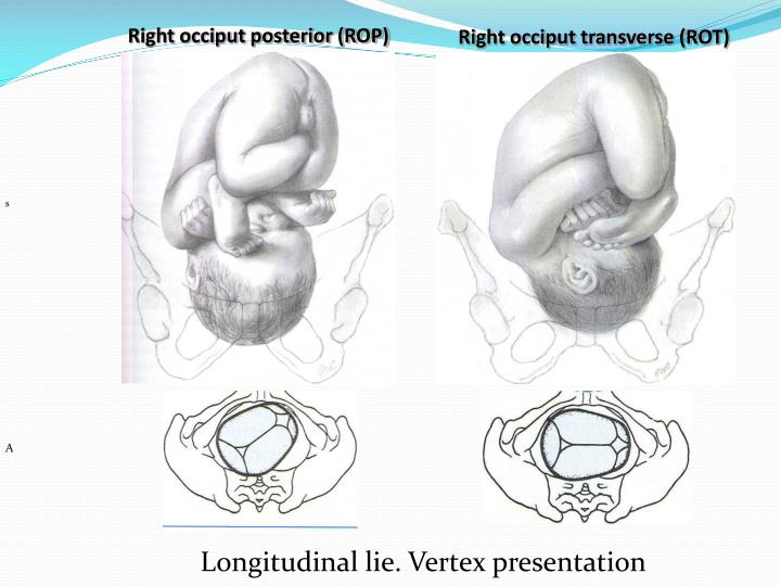 PPT - Lecture 5 PHASES OF PARTURITION STAGES OF LABOR MECHANISM OF ...