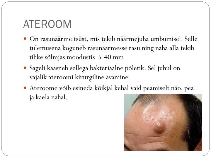 PPT - Ateroom Miilium Komedoon PowerPoint Presentation - ID:4798598