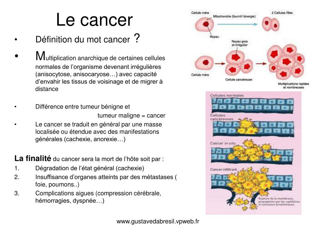 PPT - La Cancérologie PowerPoint Presentation, free download - ID:4800077