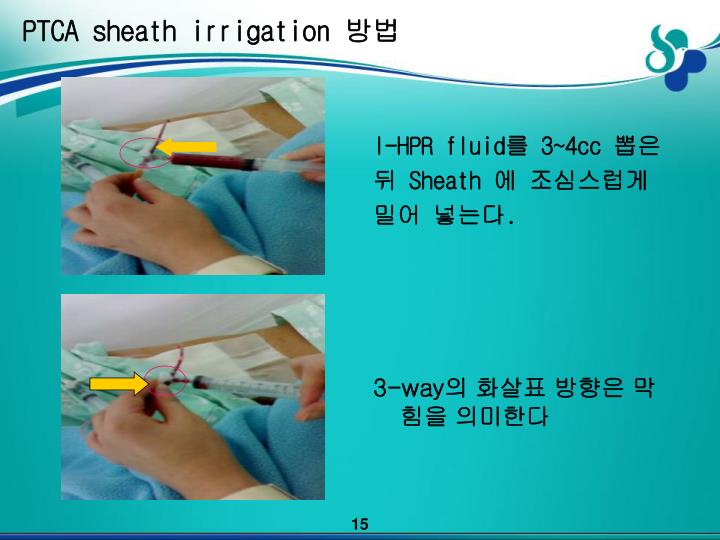 PPT - PTCA 시술과 간호 PowerPoint Presentation - ID:4800461