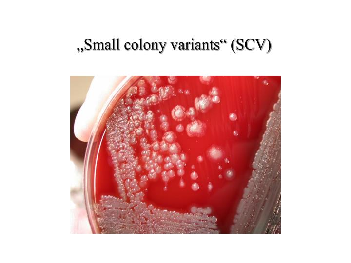 PPT - Pseudomonas aeruginosa PowerPoint Presentation - ID:4801719