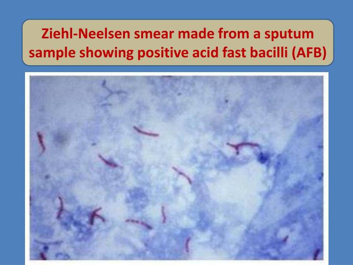 PPT - Mycobacterium tuberculosis & pulmonary tuberculosis PowerPoint ...