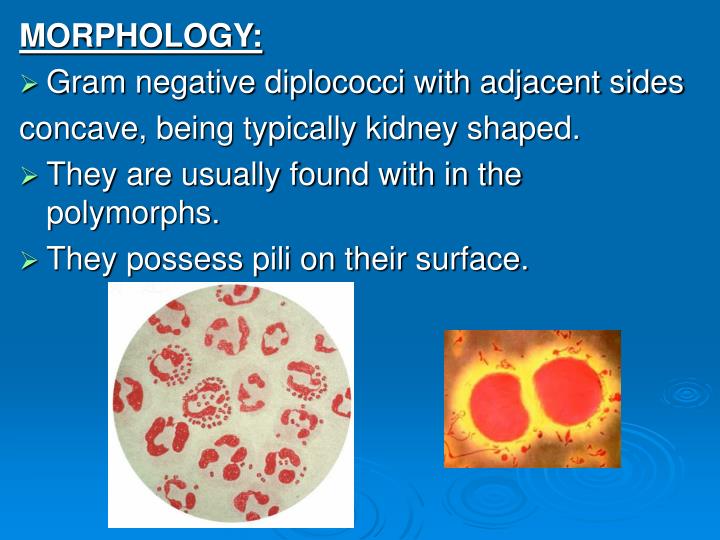 PPT - Neisseria gonorrhoeae (Gonococcus) PowerPoint Presentation - ID ...