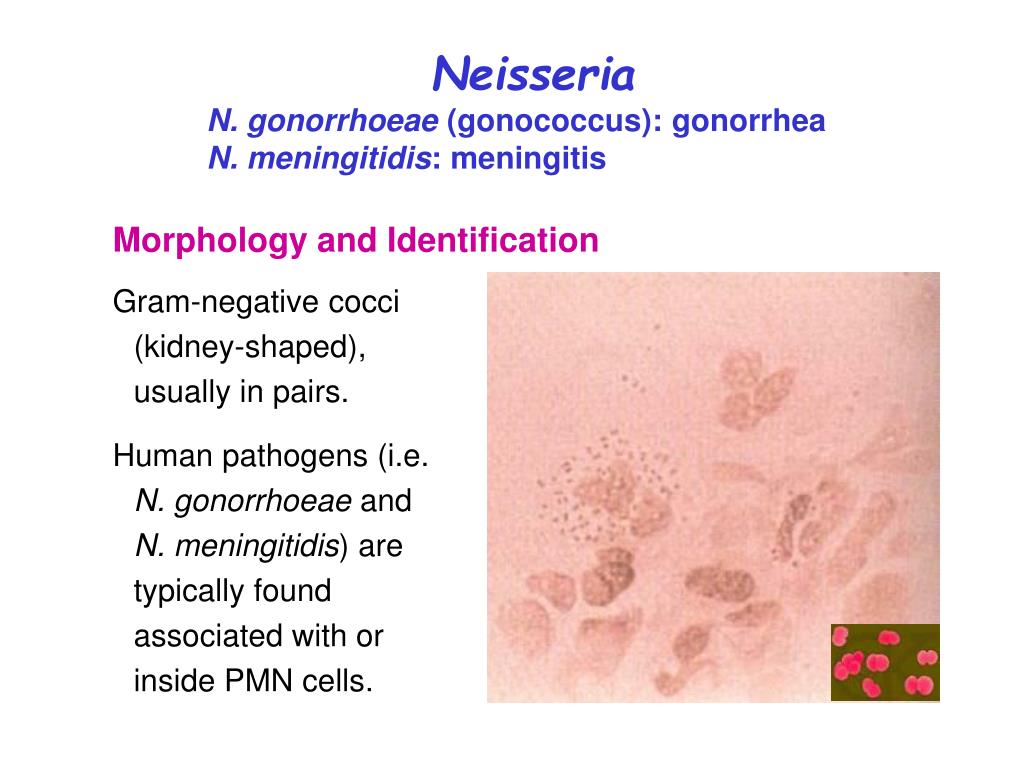 PPT - Neisseria N. gonorrhoeae (gonococcus): gonorrhea N. meningitidis ... PPT - Neisseria N. gonorrhoeae (gonococcus): gonorrhea N. meningitidis ...