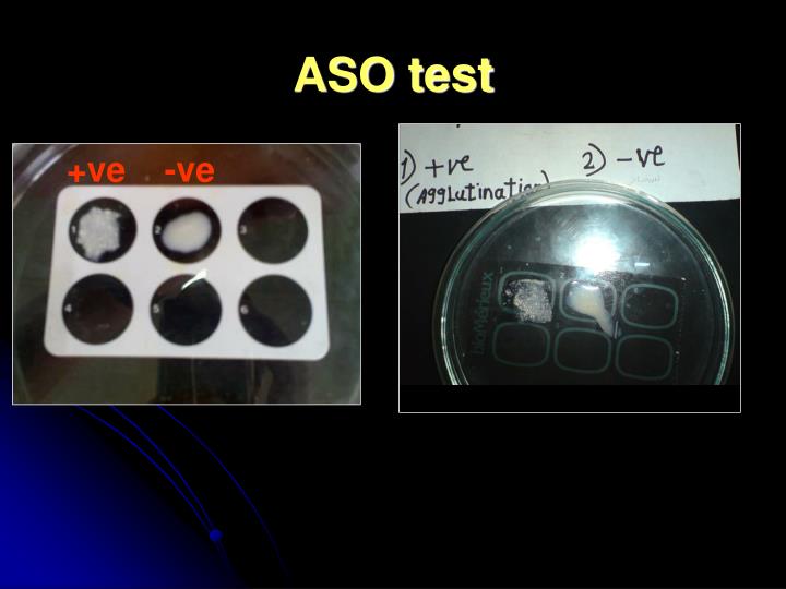 PPT - A. GRAM'S POSITIVE COCCI PowerPoint Presentation - ID:4804053
