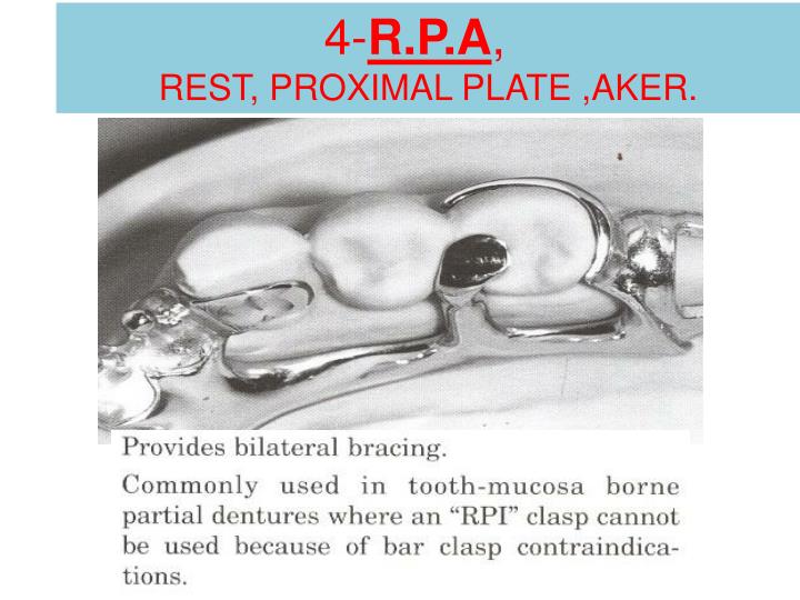 PPT - DIRECT RETENTION. PowerPoint Presentation - ID:4806159