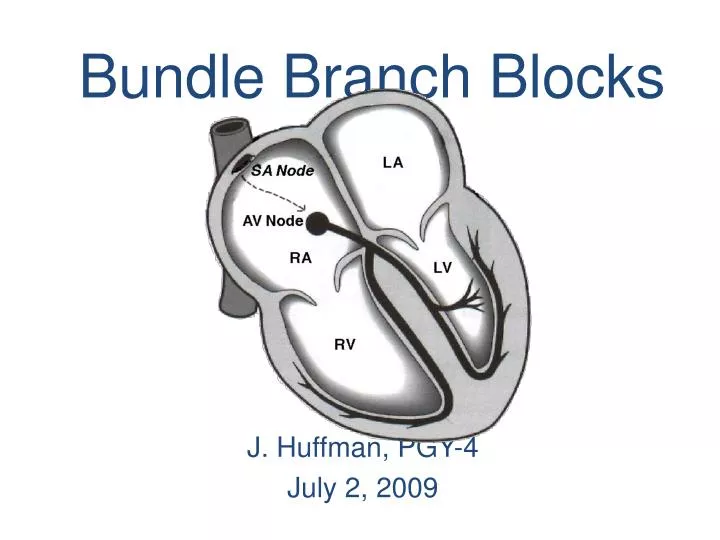 PPT - Bundle Branch Blocks PowerPoint Presentation, free download - ID ...