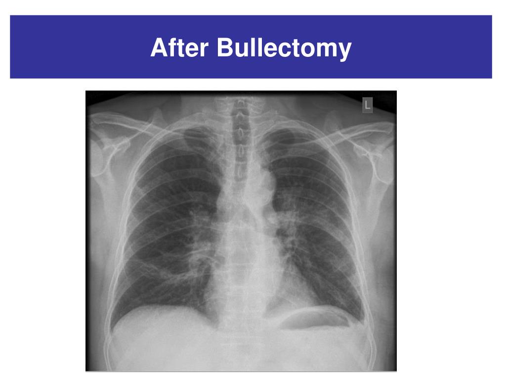 PPT - 13. Annual Congress Turkish Thoracic Society 5. – 9. May 2010 ...