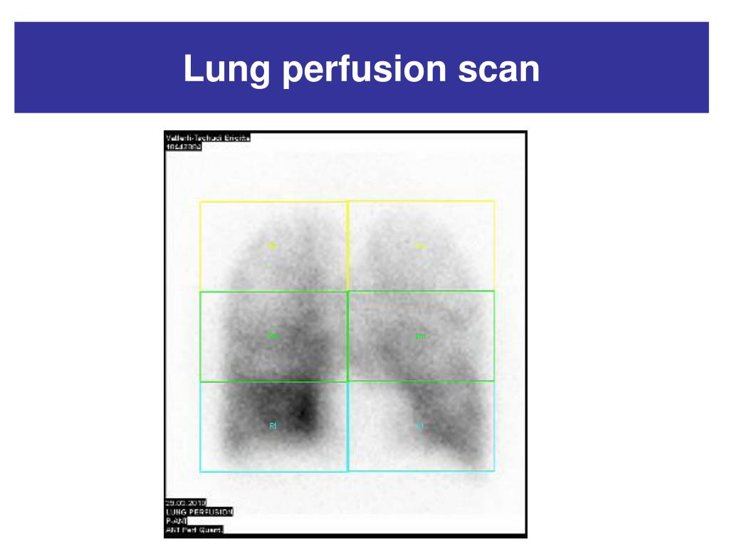 PPT - 13. Annual Congress Turkish Thoracic Society 5. – 9. May 2010 ...