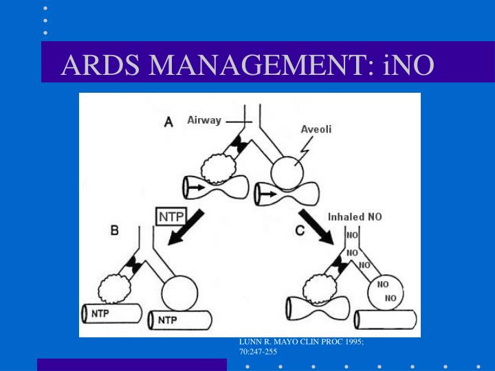 PPT - MANAGEMENT OF ARDS PowerPoint Presentation - ID:4810075