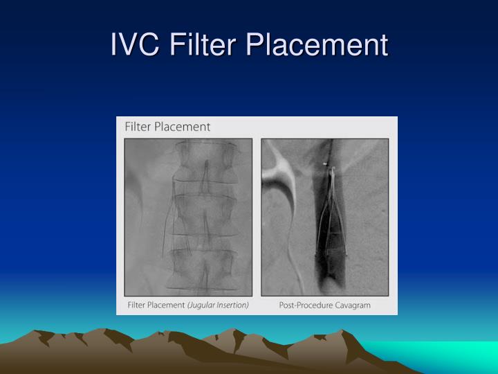 PPT - Informed Consent PowerPoint Presentation - ID:4811539