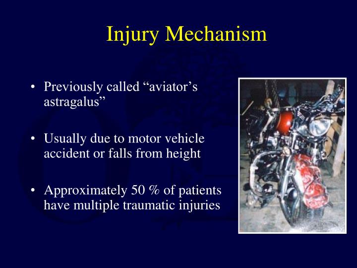 PPT - Fractures of the Talus and Subtalar Dislocations PowerPoint ...
