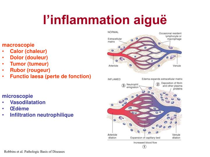 PPT - Réaction inflammatoire aigue et chronique PowerPoint Presentation ...