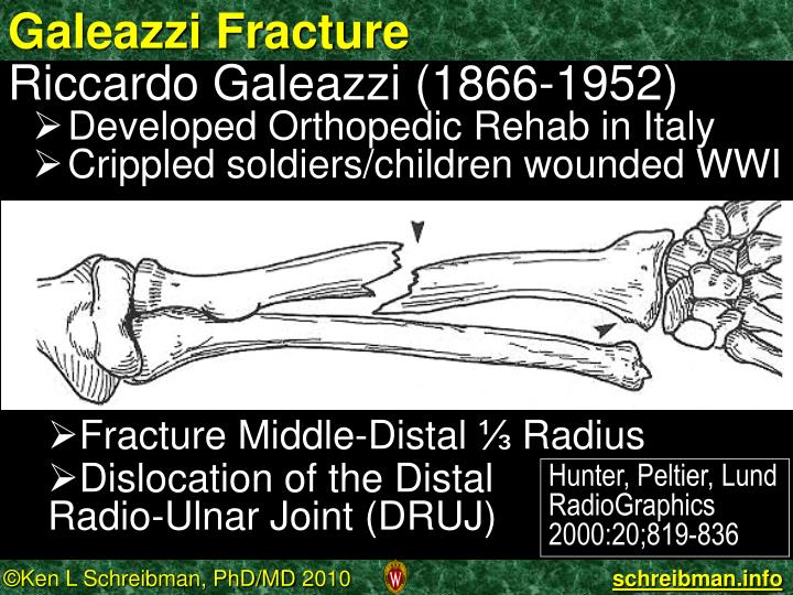 Difference between monteggia and galeazzi fracture - seryalpine
