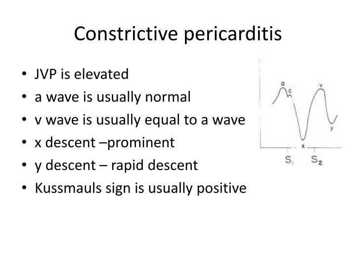 PPT - Jugular venous pressure and waveforms PowerPoint Presentation ...