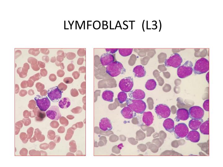 PPT - Diferenciální diagnostika leukocytóz v morfologické laboratoři ...