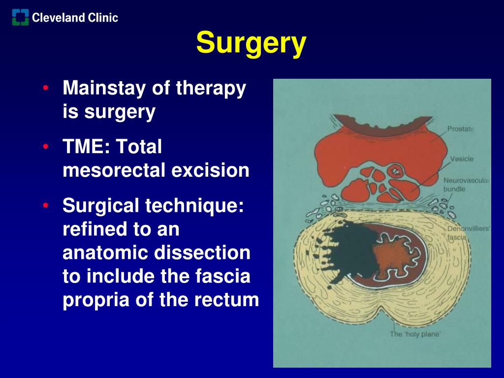 PPT - Surgical Treatment of the Low (Distal Third) Rectal Cancer ...