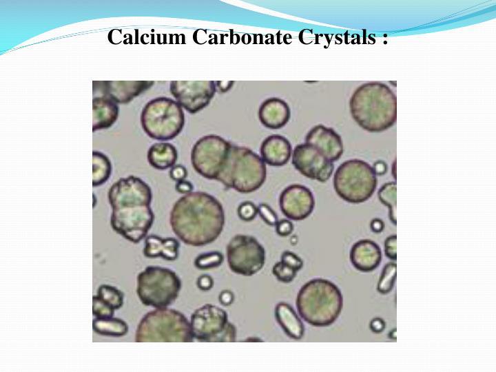 PPT - URINE AND STOOL EXAMINATION PowerPoint Presentation - ID:4831068