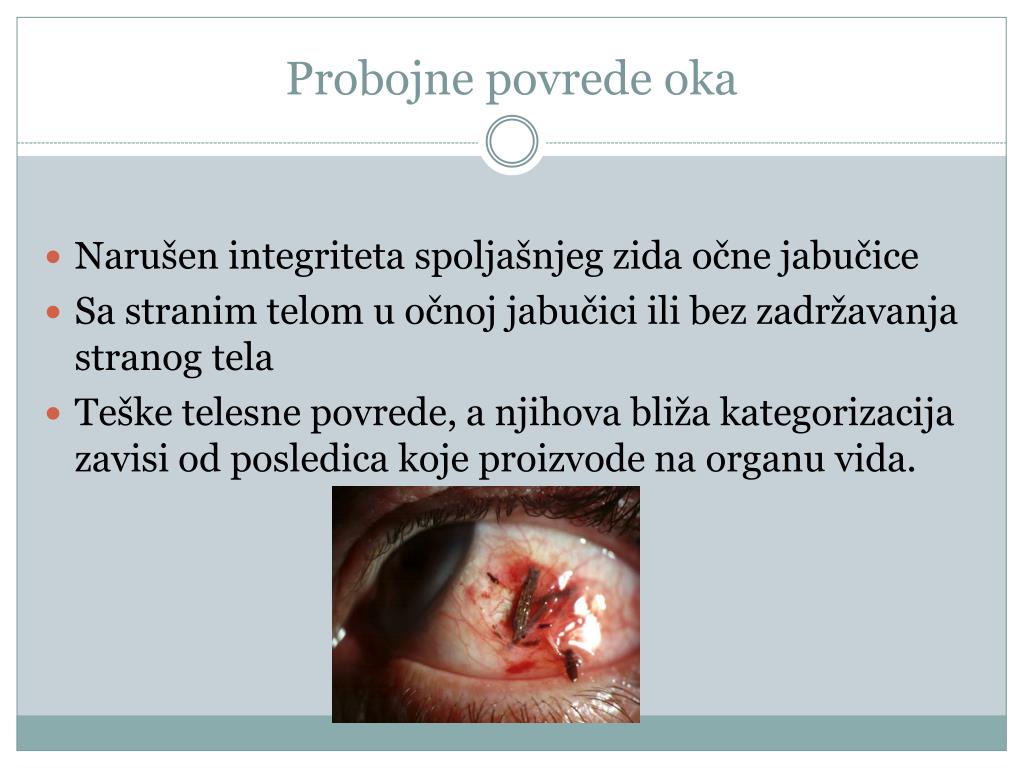 PPT - VEŠTAČENJE ŠTETE NASTALE PRI RADU NA VISINI USLED POREMEĆAJA ...