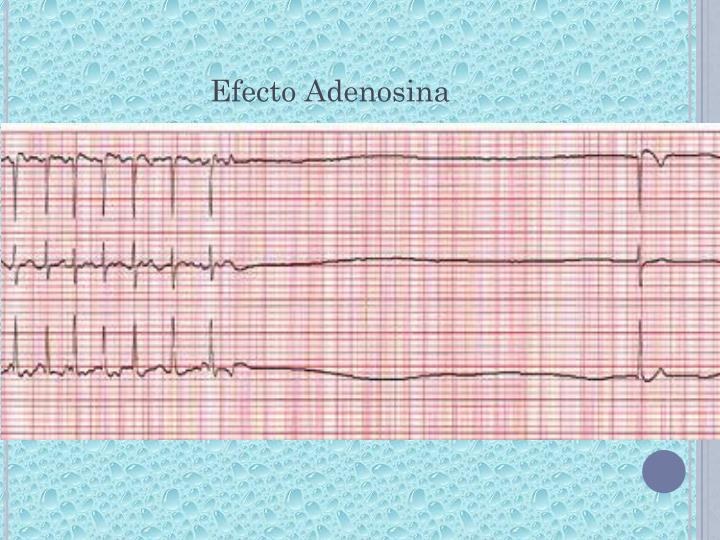 PPT - Abordaje de Tq supraventricular en servicio de urgencias ...