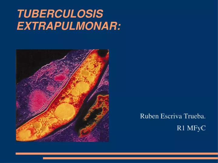 PPT - TUBERCULOSIS EXTRAPULMONAR: PowerPoint Presentation, free ...