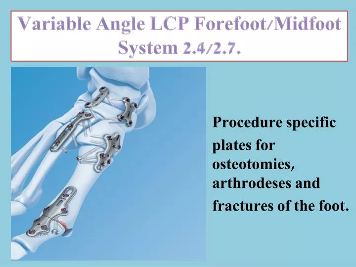 PPT - Variable Angle LCP Forefoot/ Midfoot System 2.4/2.7. PowerPoint ...
