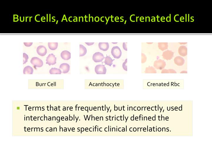 PPT - ERYTHROPOIESIS PowerPoint Presentation - ID:4835552