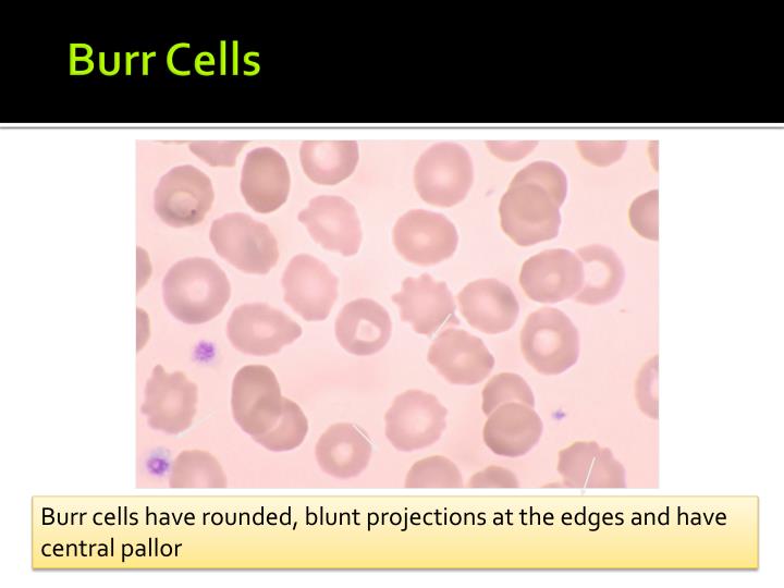 PPT - ERYTHROPOIESIS PowerPoint Presentation - ID:4835552