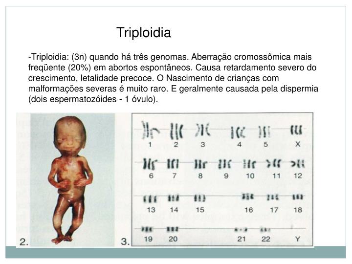 PPT - AS PRINCIPAIS ANOMALIAS GENÉTICAS NO HOMEM PowerPoint ...