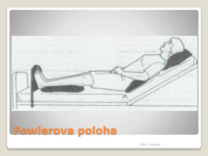 PPT - Léčebné polohy PowerPoint Presentation - ID:4840823