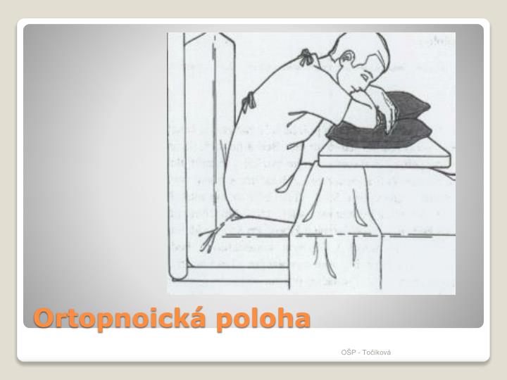 PPT - Léčebné polohy PowerPoint Presentation - ID:4840823