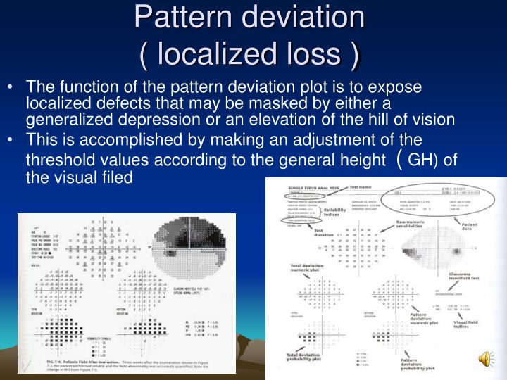PPT - Perimetry visual field PowerPoint Presentation - ID:4841127