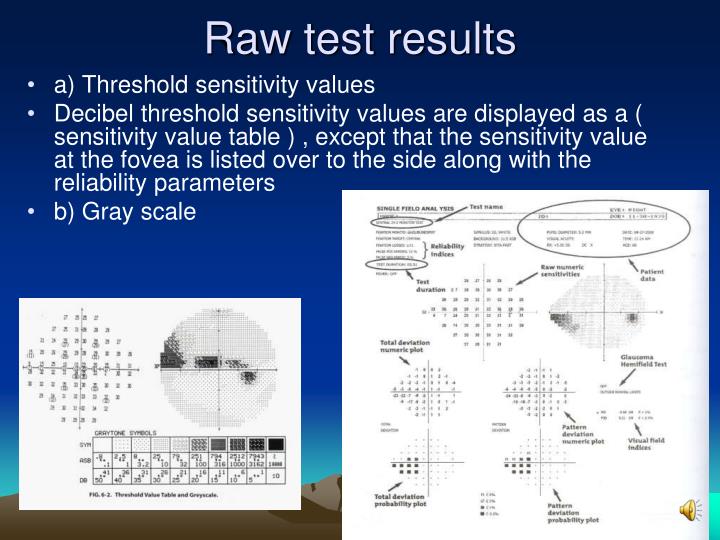 PPT - Perimetry visual field PowerPoint Presentation - ID:4841127