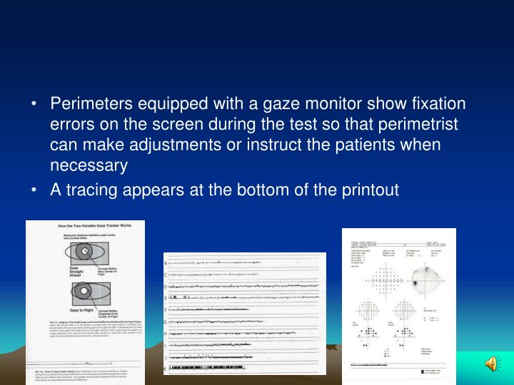 PPT - Perimetry visual field PowerPoint Presentation - ID:4841127