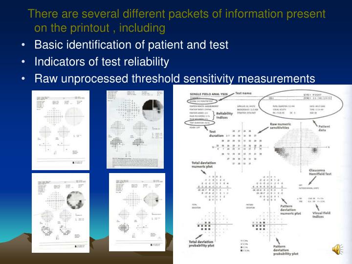 PPT - Perimetry visual field PowerPoint Presentation - ID:4841127