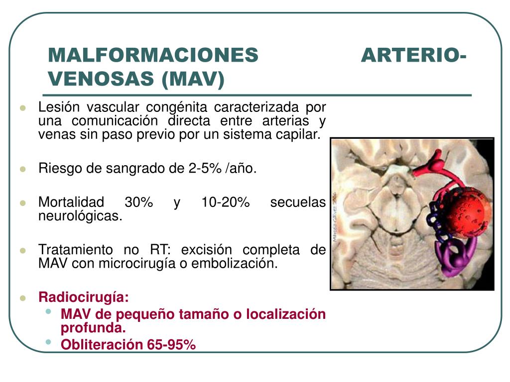 PPT - RADIOTERAPIA EN ENFERMEDADES BENIGNAS PowerPoint Presentation ...