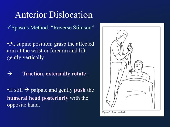 PPT - Shoulder Dislocation PowerPoint Presentation - ID:4841498