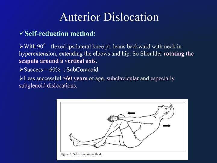 PPT - Shoulder Dislocation PowerPoint Presentation - ID:4841498