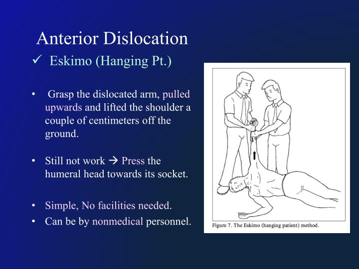 PPT - Shoulder Dislocation PowerPoint Presentation - ID:4841498
