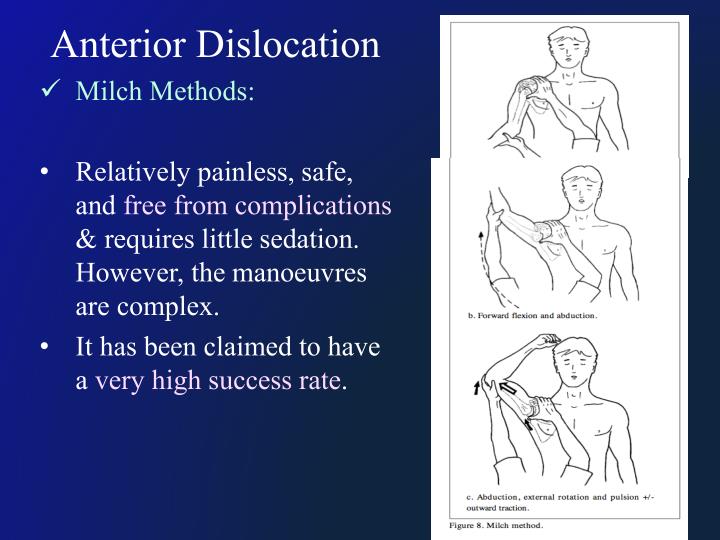 PPT - Shoulder Dislocation PowerPoint Presentation - ID:4841498