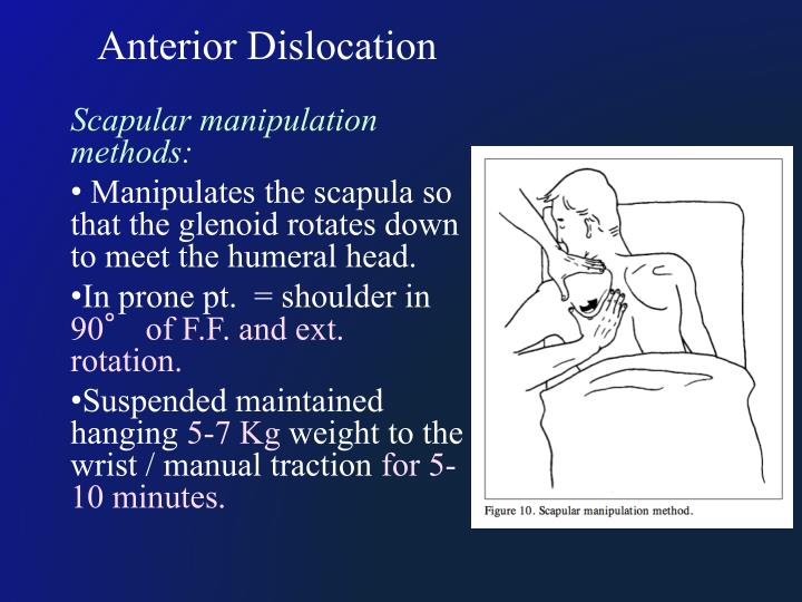 PPT - Shoulder Dislocation PowerPoint Presentation - ID:4841498