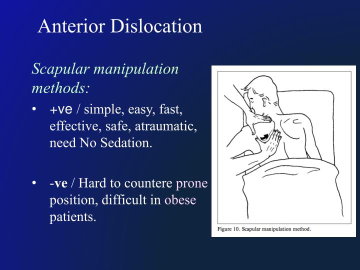 PPT - Shoulder Dislocation PowerPoint Presentation - ID:4841498